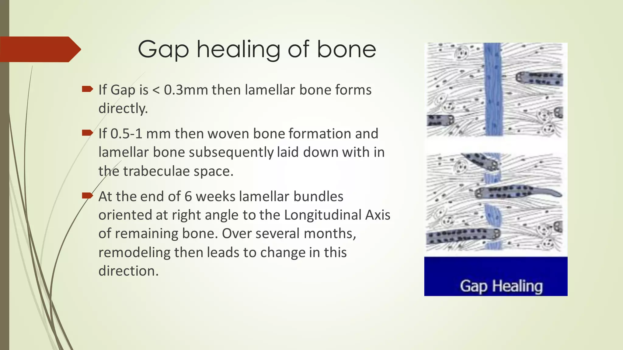 Stages of Bone healing and madalities to enhance bone healing | PDF