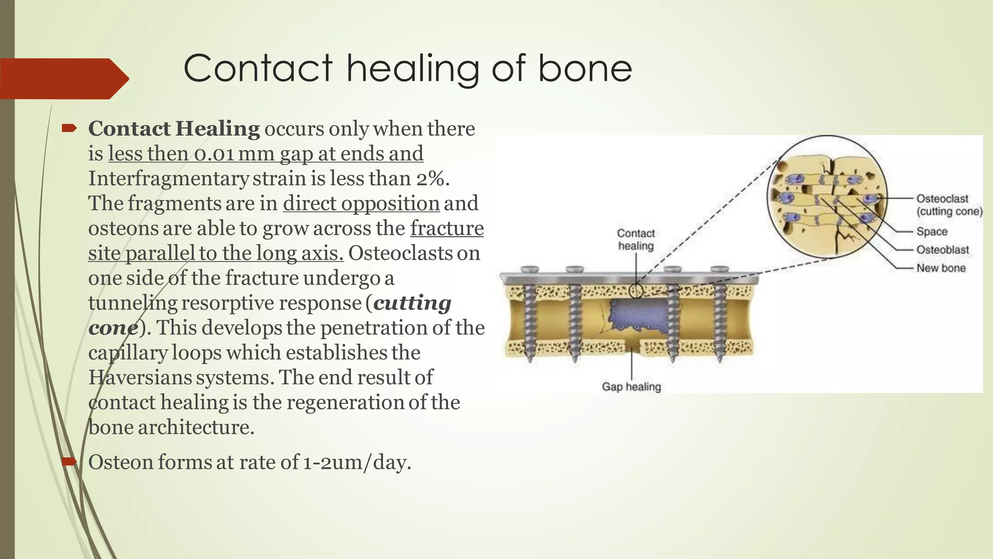 Stages of Bone healing and madalities to enhance bone healing | PDF