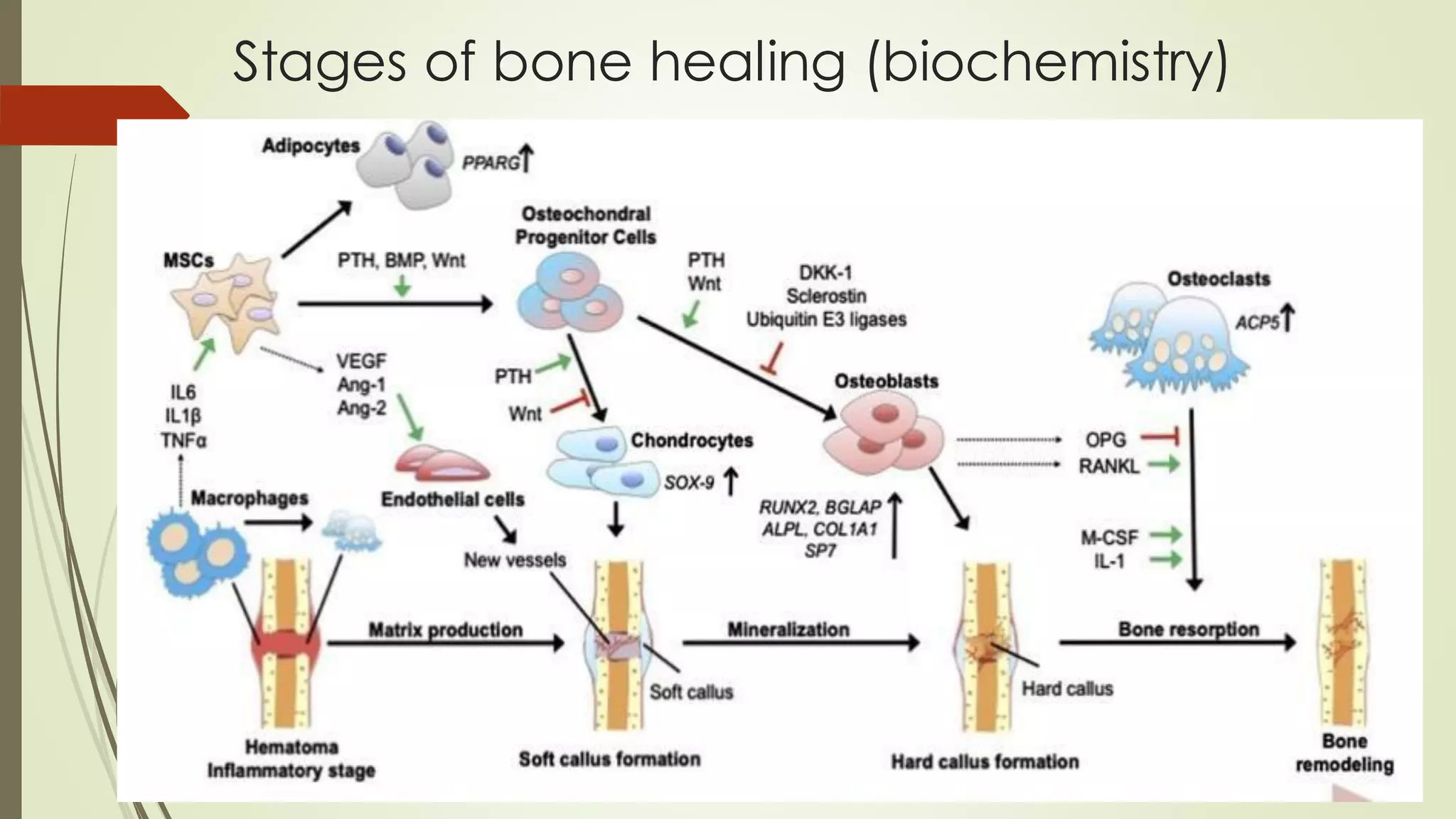 Stages of Bone healing and madalities to enhance bone healing | PPT