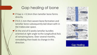 Stages of Bone healing and madalities to enhance bone healing | PDF