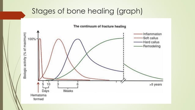 Stages of Bone healing and madalities to enhance bone healing
