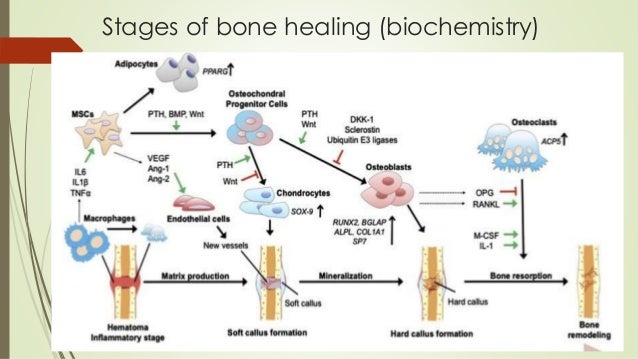 Stages of Bone healing and madalities to enhance bone healing