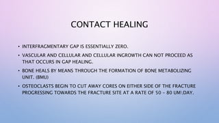 bone healing.pptx