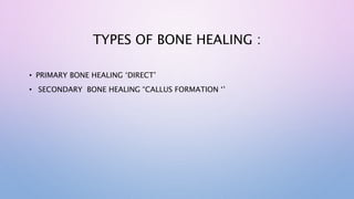 bone healing.pptx