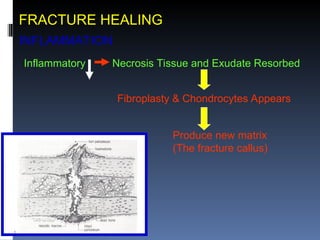 Bone Healing PATHOLOGY.ppt in radiography | PPT