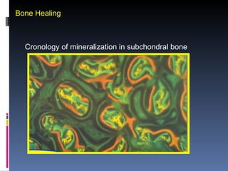 Bone Healing PATHOLOGY.ppt in radiography | PPT