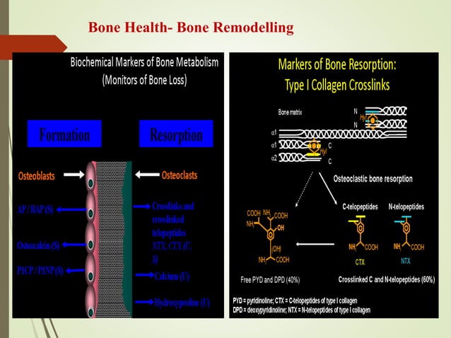 vitamin D & Bone health | PPT