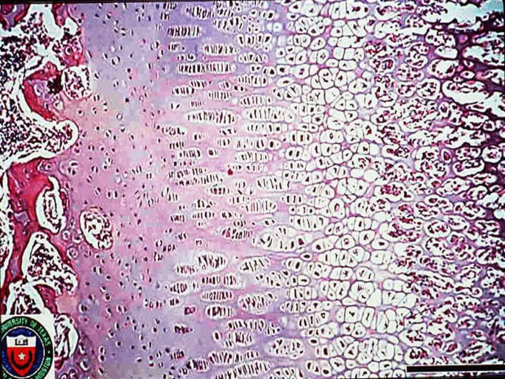 Bone histology amir | PPT