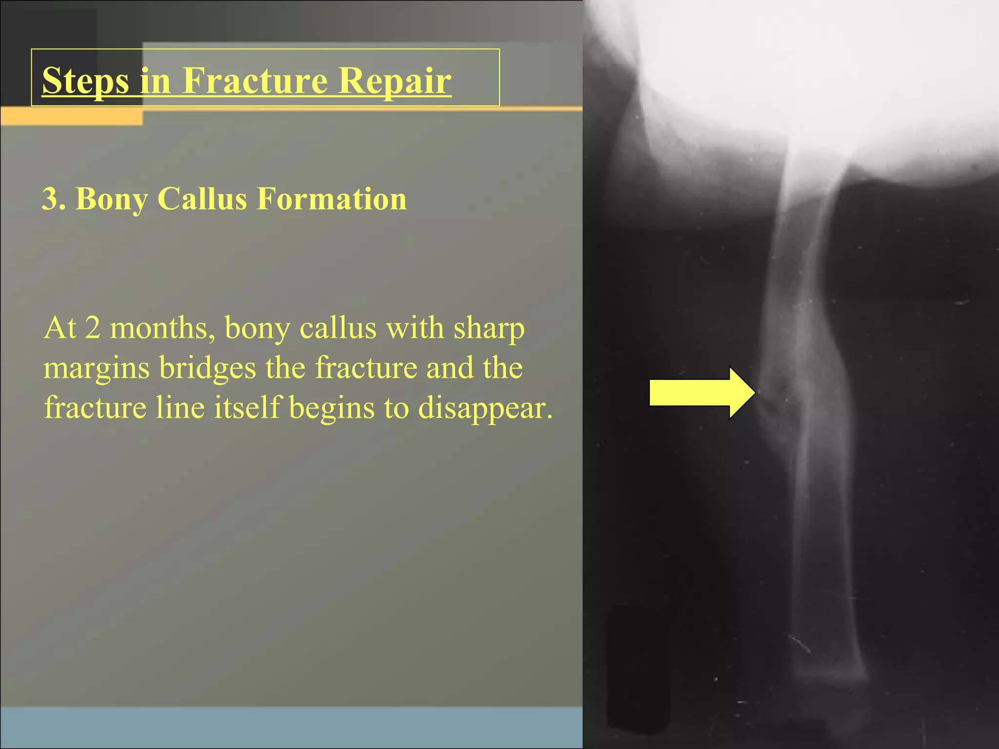 Bone Tissue (Jaringan Tulang) | PPT