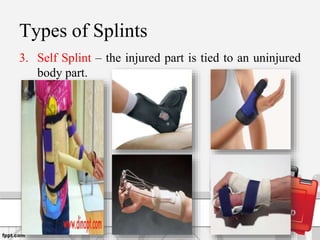 Bone, joint, and muscle injuries | PPTX