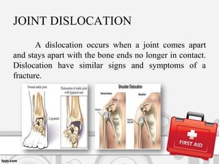 Bone, joint, and muscle injuries | PPTX
