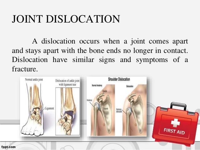 Bone, joint, and muscle injuries