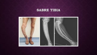 Sabre Tibia