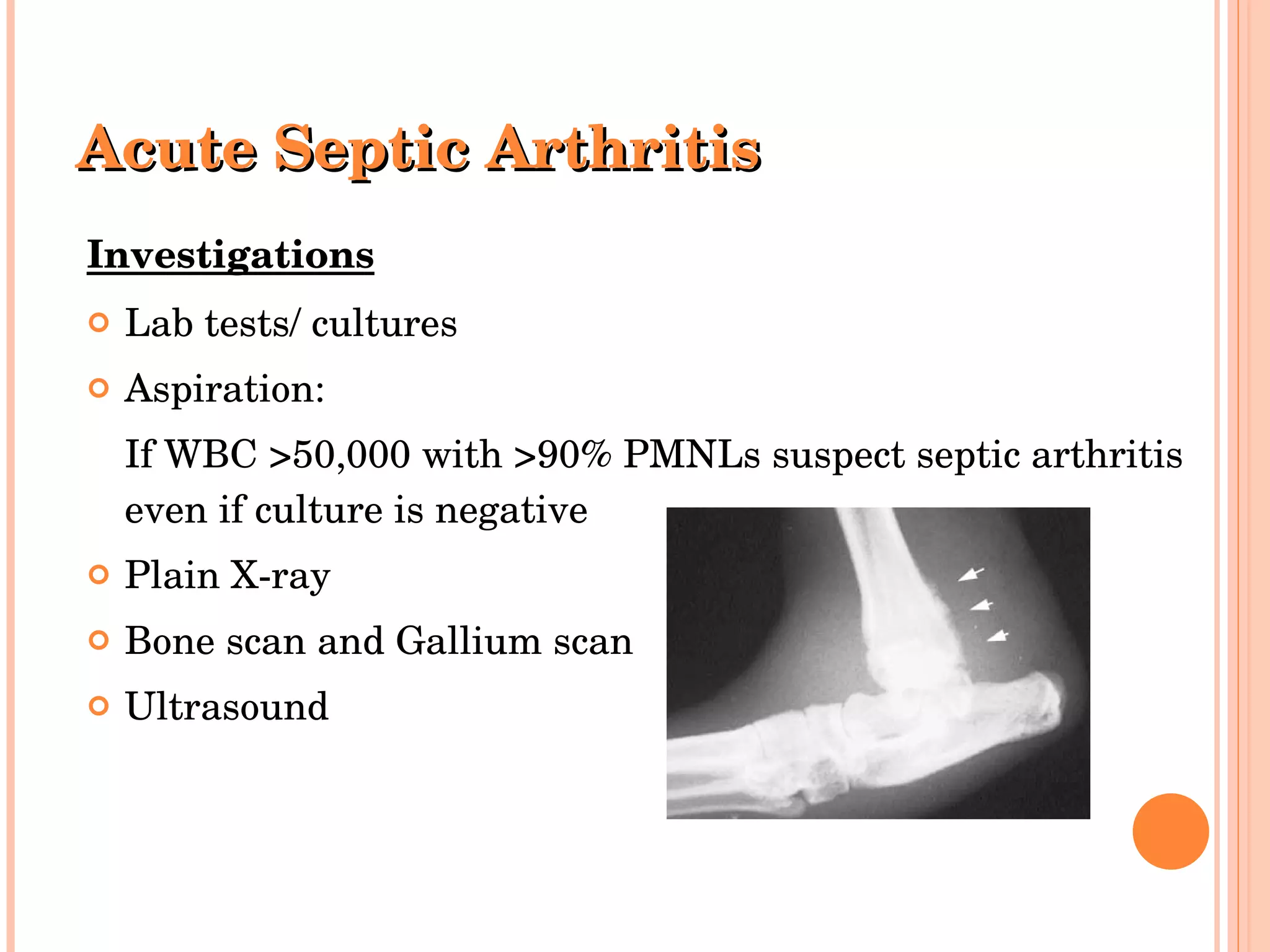 Bone+joint infections | PPT