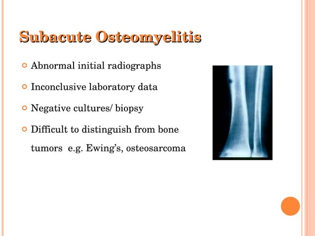 Bone+joint infections | PPT | Bone and Joint Conditions | Diseases and Conditions