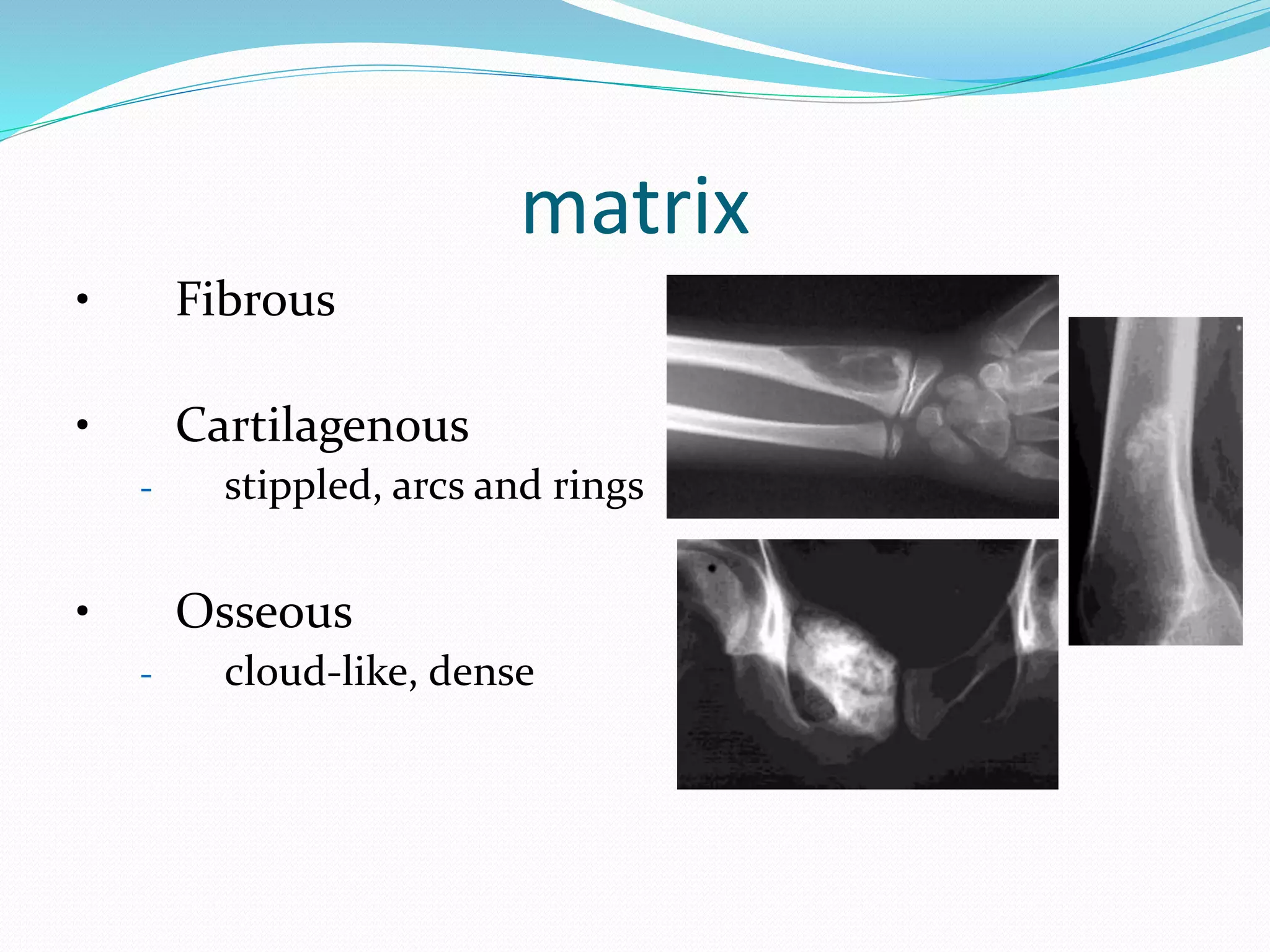Bone Lesion Approach.pptx
