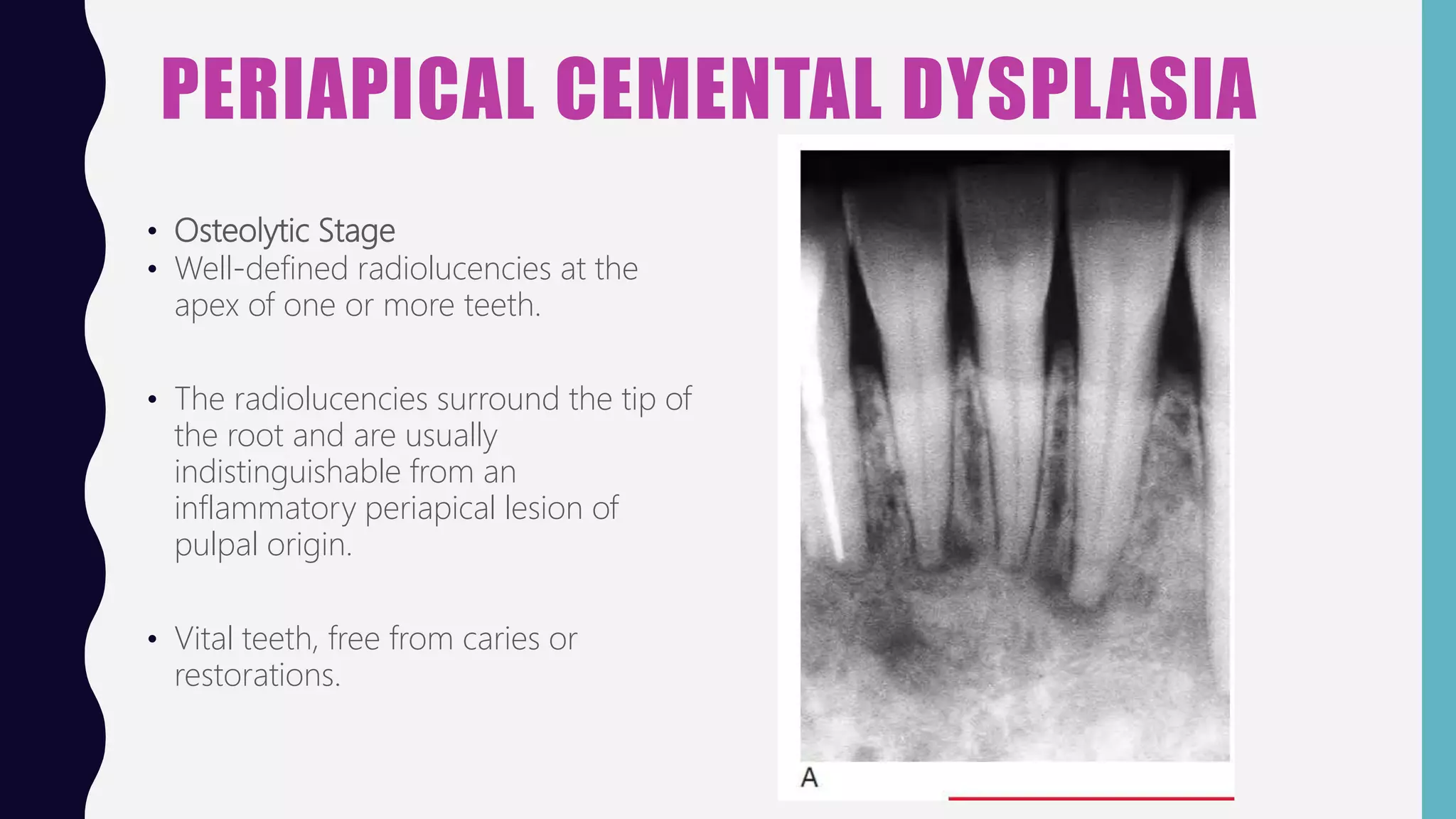 Bone Lesions Oral Pathology | PPTX