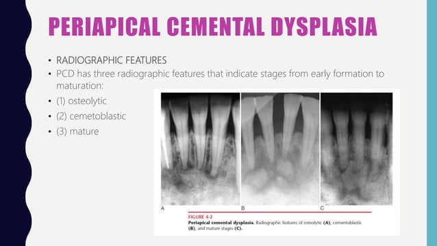 Bone Lesions Oral Pathology | PPTX
