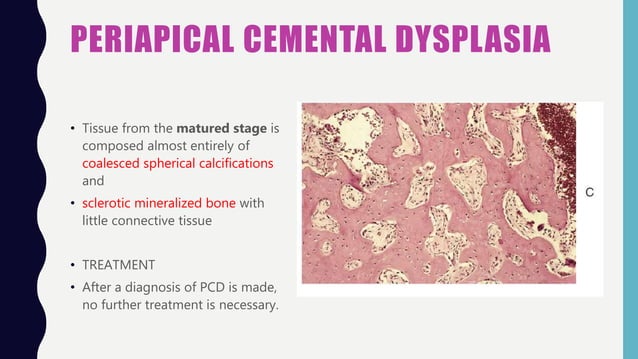 Bone Lesions Oral Pathology | PPTX