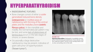 Bone Lesions Oral Pathology | PPT