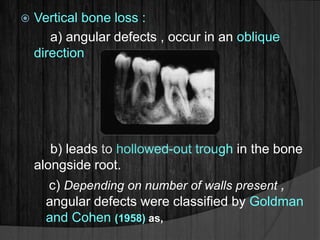 Bone loss and patterns of bone destruction | PPTX