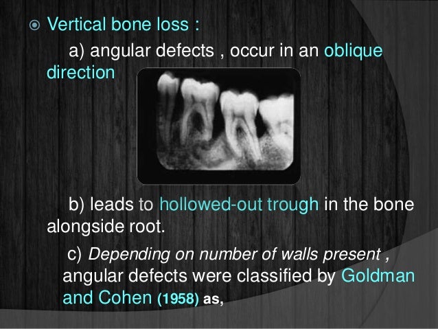 Bone loss and patterns of bone destruction