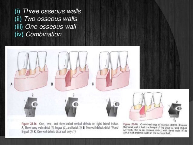 Bone loss and patterns of bone destruction