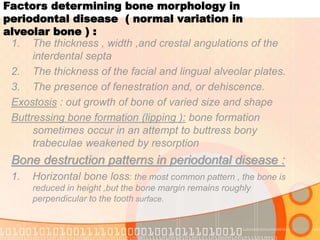 BONE LOSS.ppt