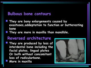 BONE LOSS & patterns of Bone destruction | PPT