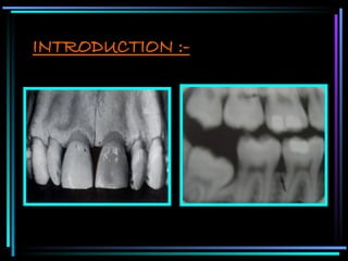 BONE LOSS & patterns of Bone destruction | PPT