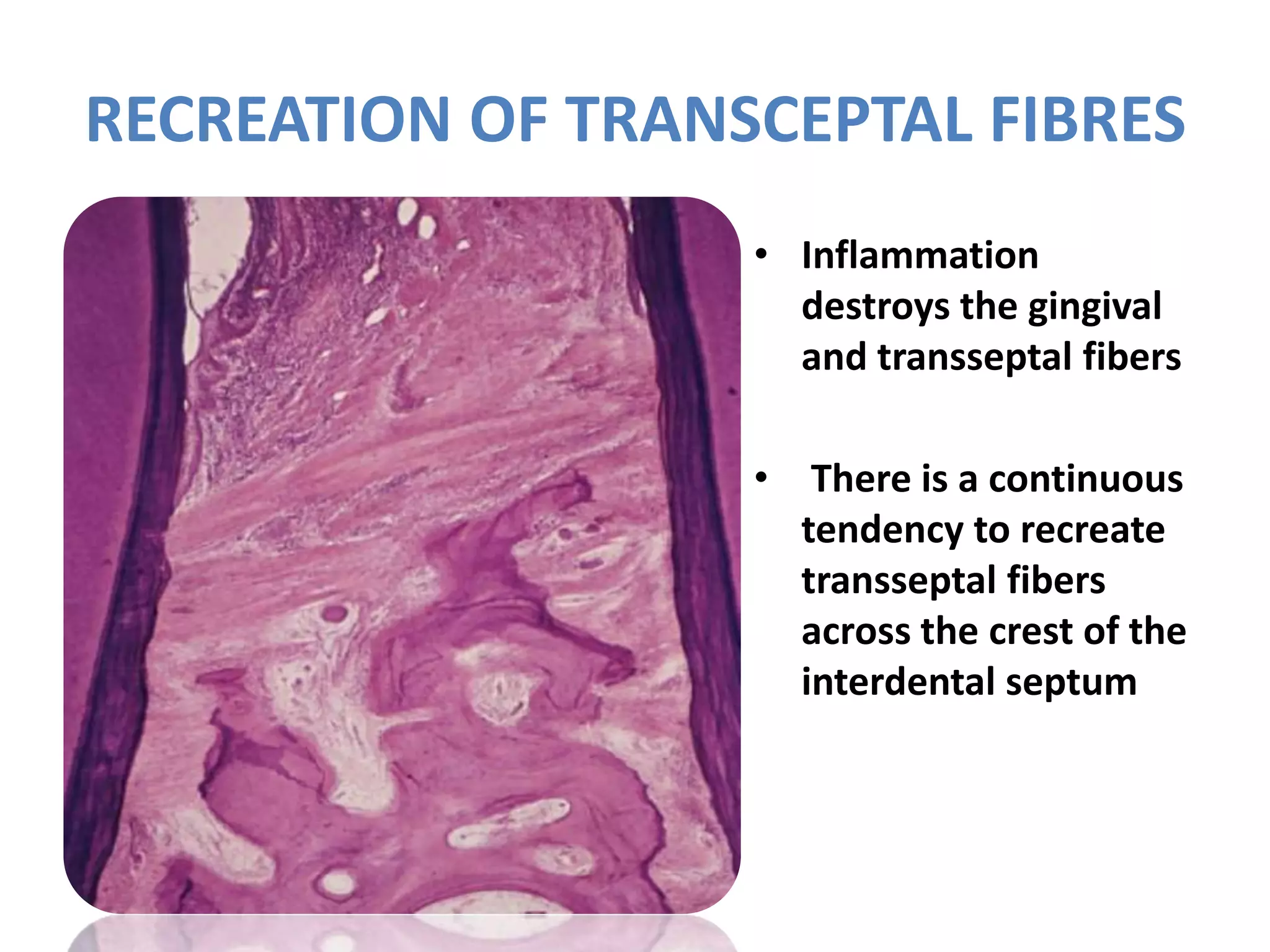 MECHANISM AND MEDIATORS OF BONE DESTRUCTION | PPTX
