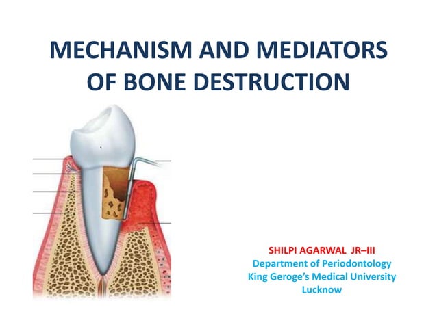 MECHANISM AND MEDIATORS OF BONE DESTRUCTION | PPTX | Bone and Joint ...