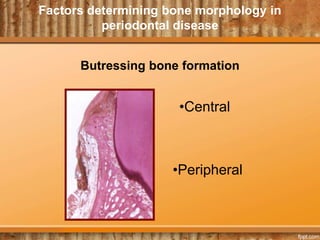 Bone loss and pattern of destruction | PPTX