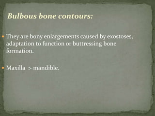 Bone loss and patterns of bone destruction | PPTX