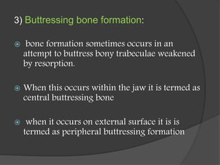 Bone loss and patterns of bone destruction | PPTX