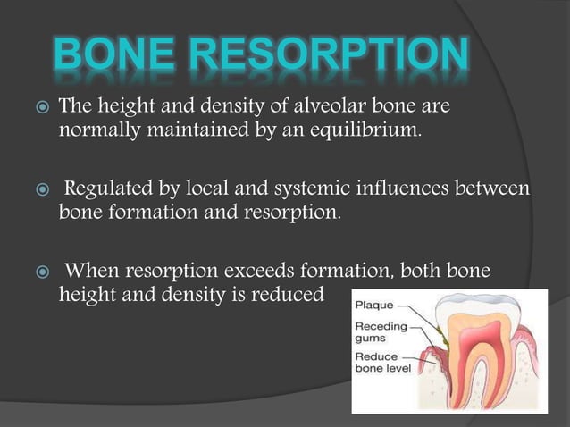 Bone loss and patterns of bone destruction | PPTX | Bone and Joint ...