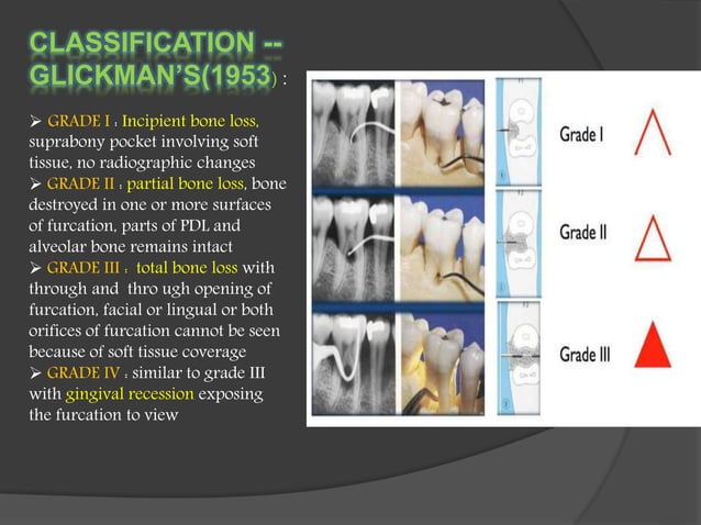 Bone loss and patterns of bone destruction
