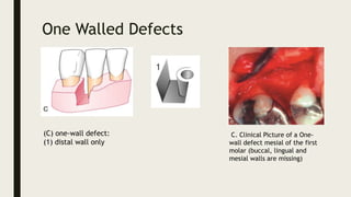 BONE LOSS AND PATTERNS OF BONE DESTRUCTION.pptx