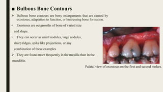 BONE LOSS AND PATTERNS OF BONE DESTRUCTION.pptx