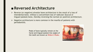 BONE LOSS AND PATTERNS OF BONE DESTRUCTION.pptx