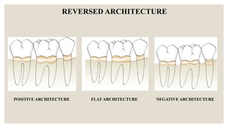 BONE LOSS AND PATTERNS OF BONE DESTRUCTION.pptx