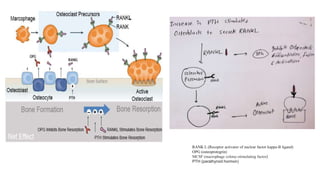 BONE LOSS AND PATTERNS OF BONE DESTRUCTION ishu.pptx