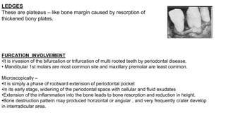 BONE LOSS AND PATTERNS OF BONE DESTRUCTION ishu.pptx