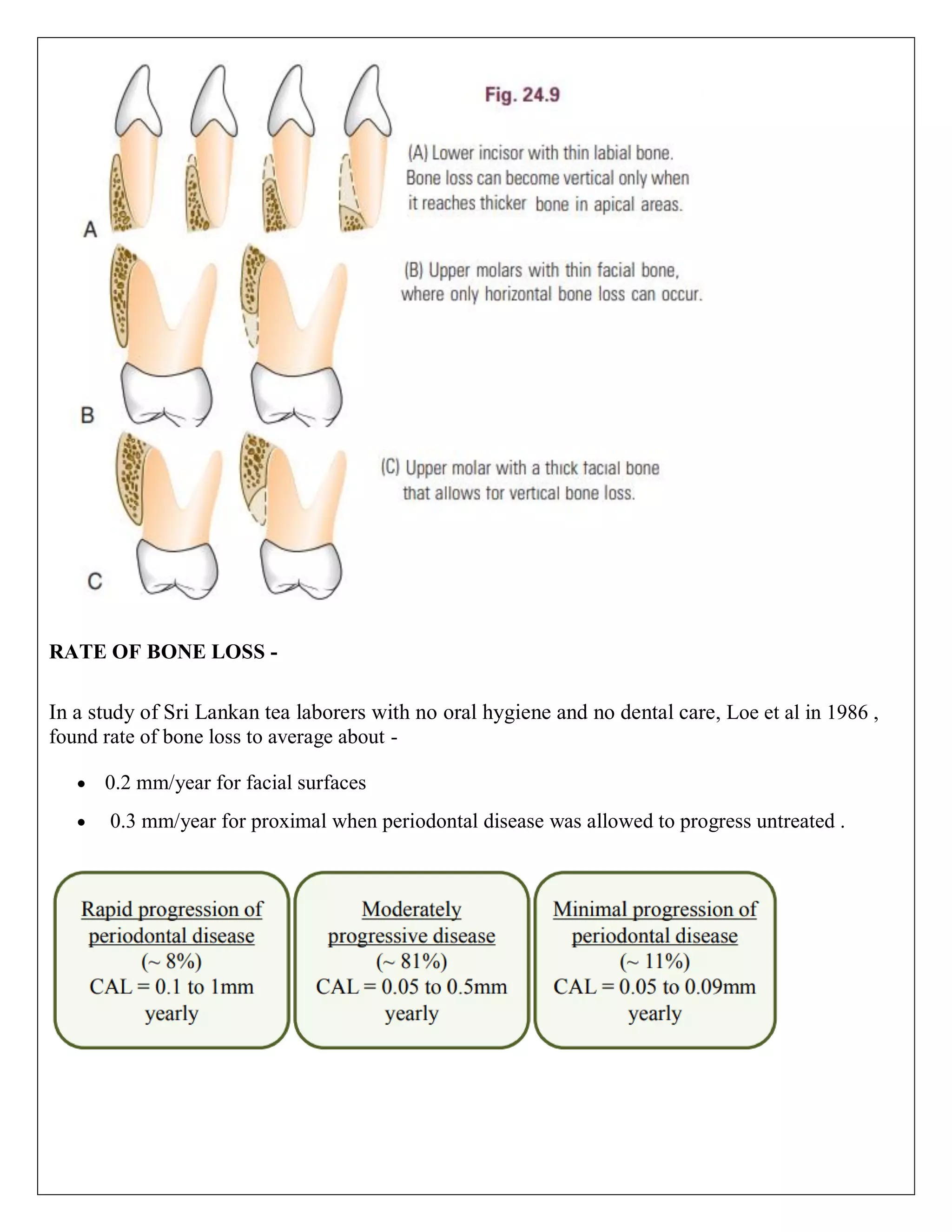 Bone loss patterns | PDF