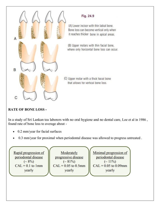 Bone loss patterns | PDF | Bone and Joint Conditions | Diseases and ...