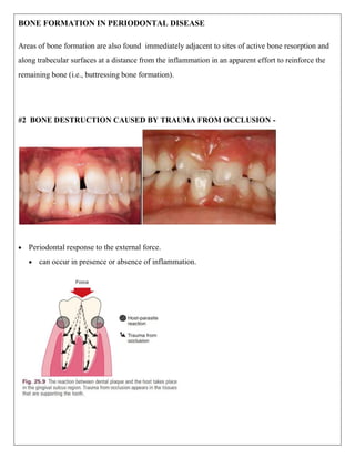 Bone loss patterns | PDF | Bone and Joint Conditions | Diseases and ...