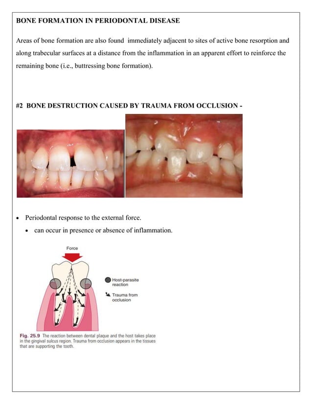 Bone loss patterns | PDF | Bone and Joint Conditions | Diseases and ...