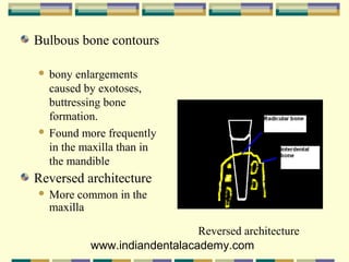 Bone loss & patterns of bone loss / /certified fixed orthodontic ...