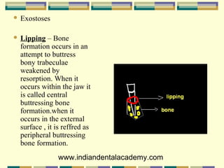 Bone loss & patterns of bone loss /certified fixed orthodontic courses ...