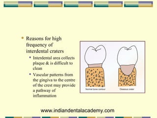 Bone loss & patterns of bone loss /certified fixed orthodontic courses ...